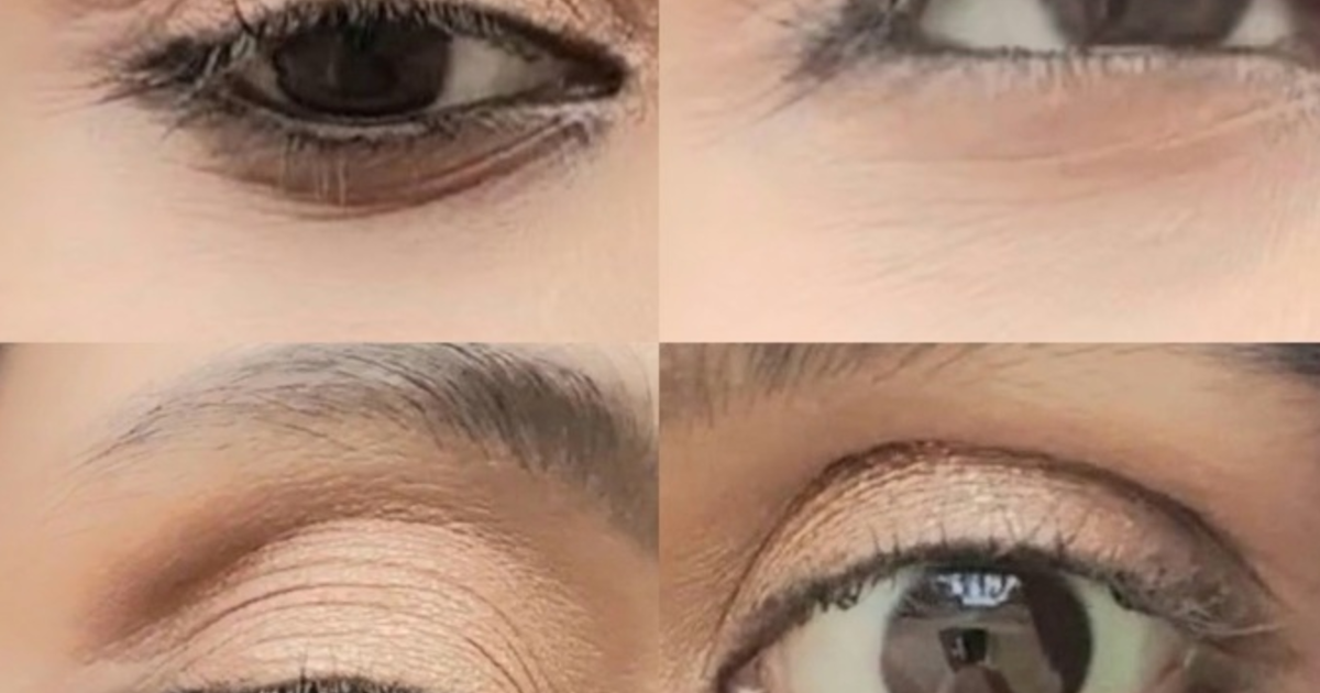 Fine lines under eyes? - GirlsAskGuys
