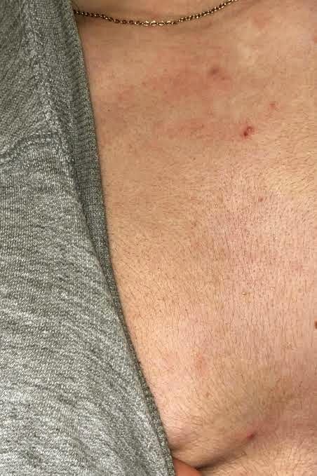 But fuzzy chest on a girl? - GirlsAskGuys