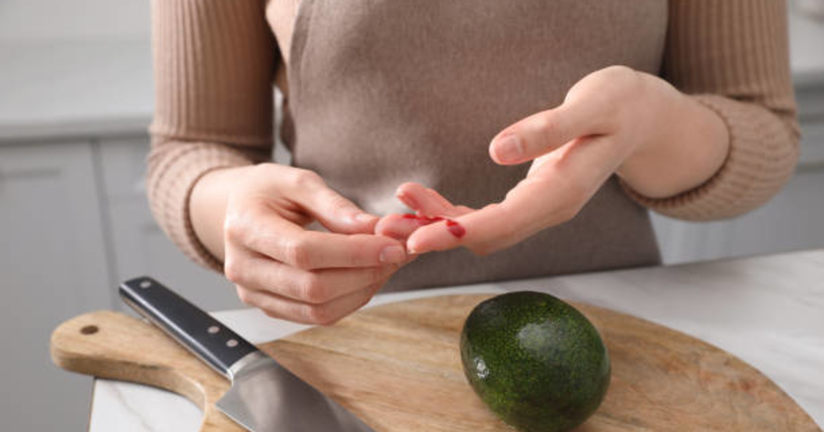 What would you do if your partner accidentally cut their own finger off ...
