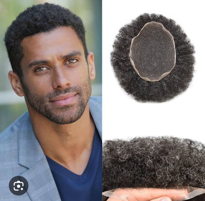 I’m not attracted to bald man and my husband is balding. How can I ...