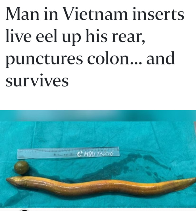 藍藍藍Are you aware that you should never insert an eel up your anus ...