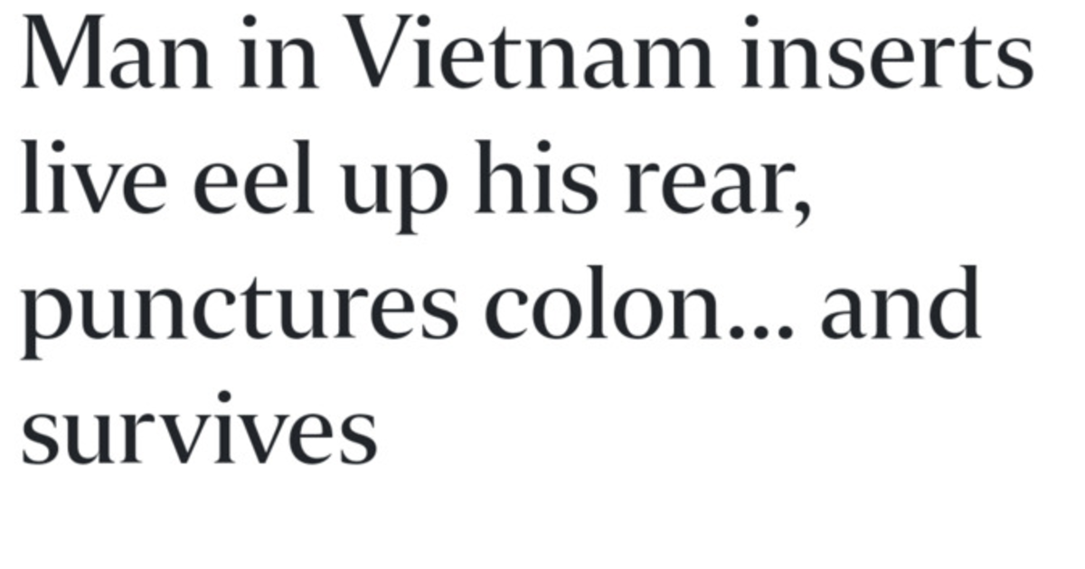 藍藍藍Are you aware that you should never insert an eel up your anus ...