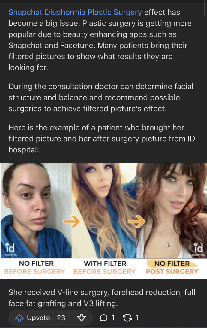 Should I get surgery to look like this filter? ? - GirlsAskGuys