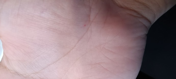 What are these red dots? - GirlsAskGuys