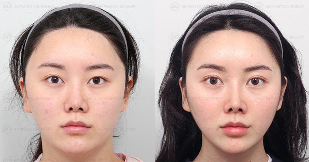 Why are people shamed for altering their appearances? - GirlsAskGuys