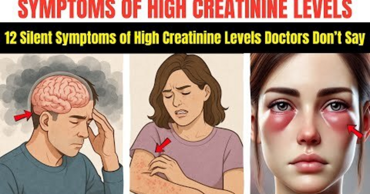 12 Symptoms of high. CREATININE levels in your body. Do you or someone ...