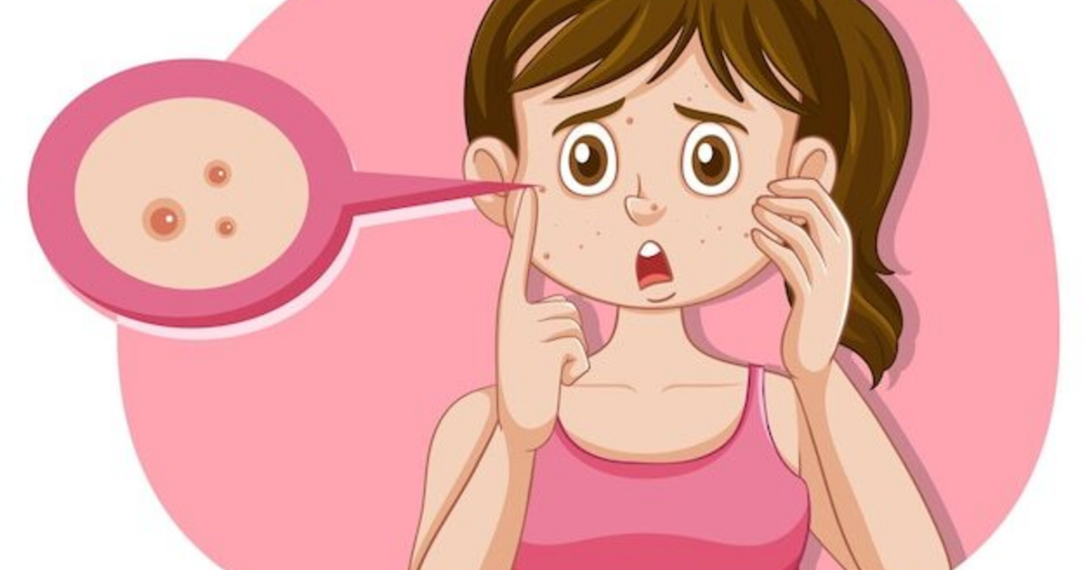 Where do you think is the worst place on your body to have a pimple ...